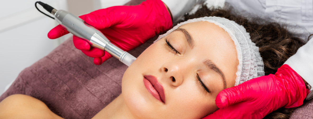 Microneedling – Ai Skin Clinic